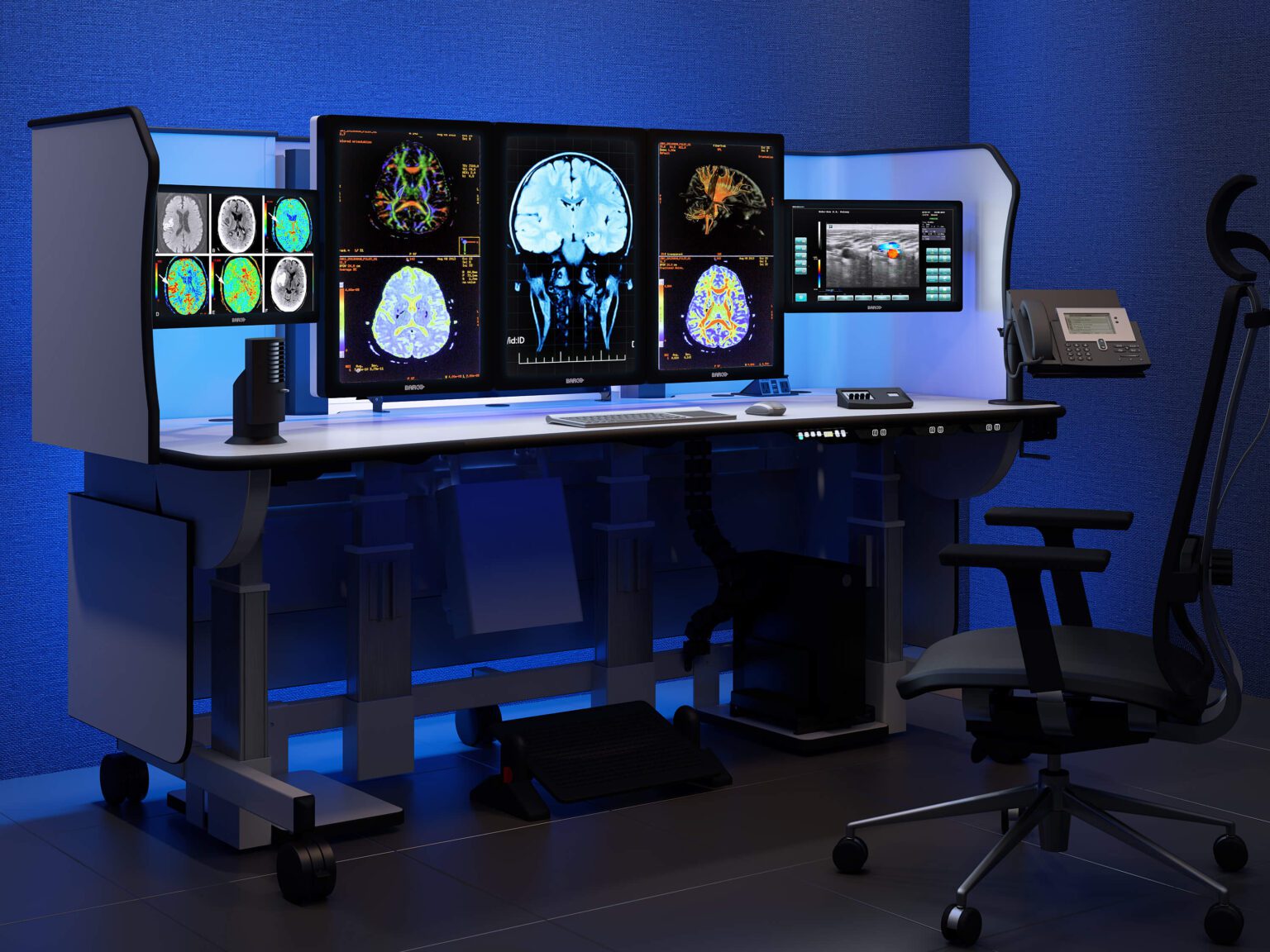 Radiology Workstations: A Cornerstone of Modern Image Diagnosis